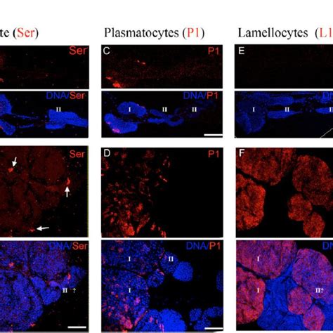 The Mutant Lymph Gland Contains Differentiated Hemocytes Confocal