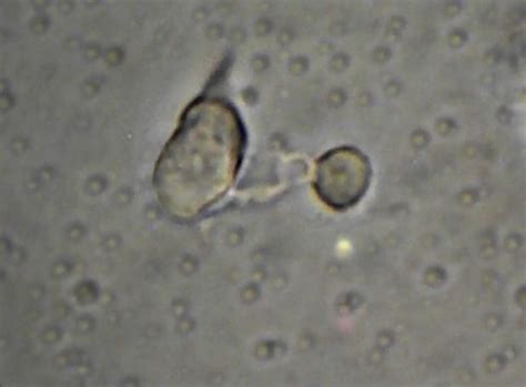 Trichomoniasis Microscope Trichomonas Moving Under The Microscope