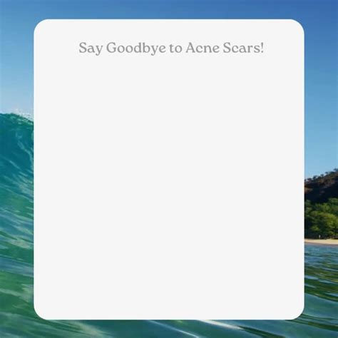 Sofwave On Linkedin Sofwave Treats Acne Scars