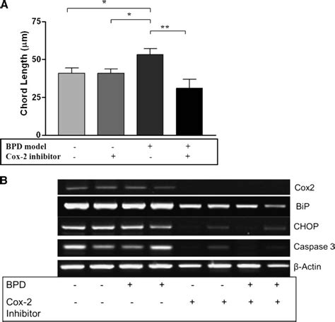 Hyperoxia And Interferon γinduced Injury In Developing Lungs Occur Via