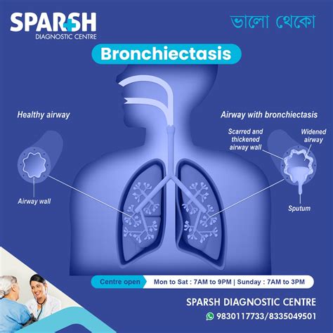 Sparsh Bronchiectasis Is A Chronic Lung Condition Where Damaged
