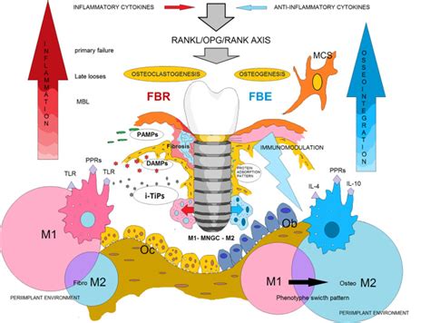 Osteoimmune Regulation Underlies Oral Implant Osseointegration And Its