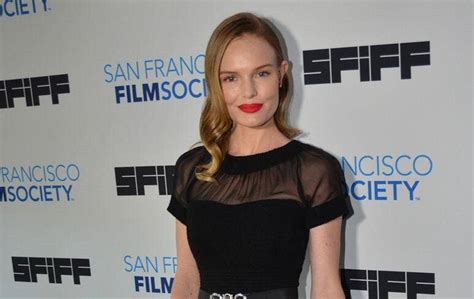 16 Celebrities With Super Freaky Physical Deformities Yourtango