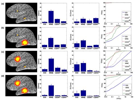 spatially sparse source cluster modeling by compressive neuromagnetic