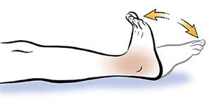Hip Replacement Treatment Home Physio Group