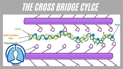 What Is Cross Bridging At Paul Caison Blog