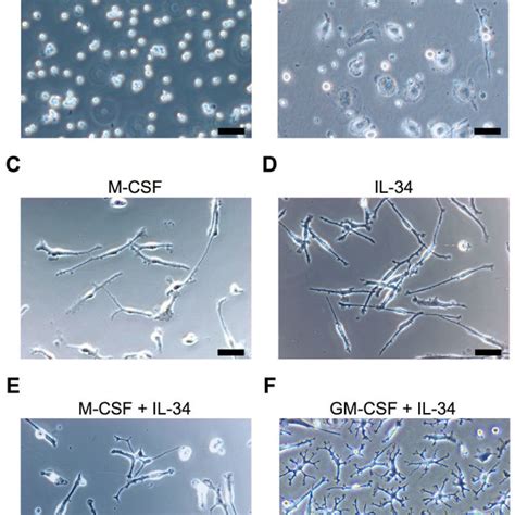 The Monocytes On The Day Of Isolation A Were Incubated With The Download Scientific Diagram