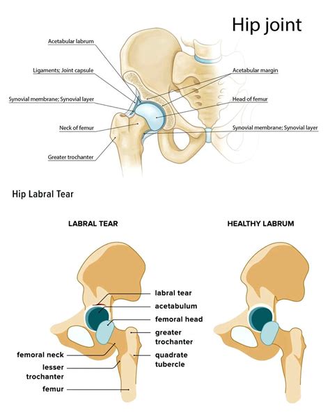 Hip Labral Tear Tests Eps Chiropractic Team