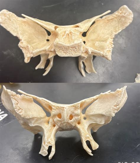 Sphenoid Bone Diagram Quizlet