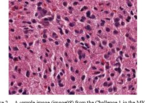 Figure 1 From Segmentation Of Nuclei In Digital Pathology Images