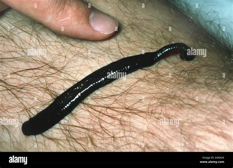Leech