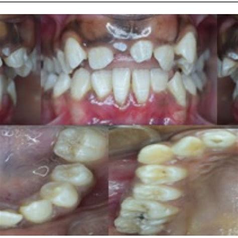 Orthopantogram View Download Scientific Diagram
