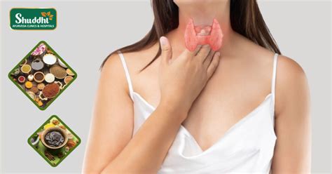 Herbal Solutions For Natural Thyroid Balance By Shuddhi Ayurveda