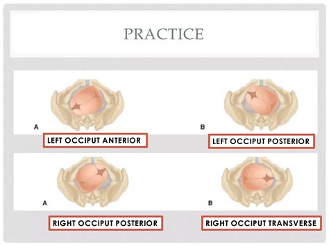 Fetal Position Pdf