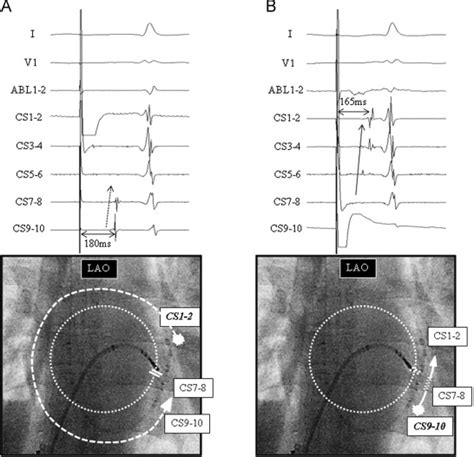 Demonstration Of A Unidirectional Conduction Block On The Mitral Download Scientific Diagram