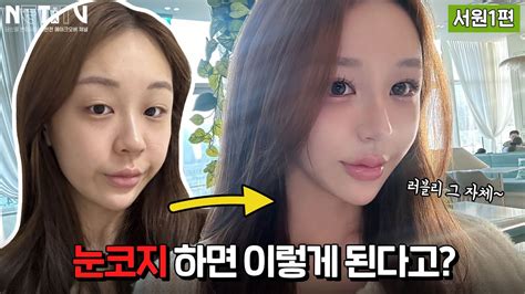 정말 엄청나요 이렇게 달라질수 있다니 다른 사람을 만들어 버리는 마법의 눈코지성형 쌍수코수술얼굴지방이식 Youtube