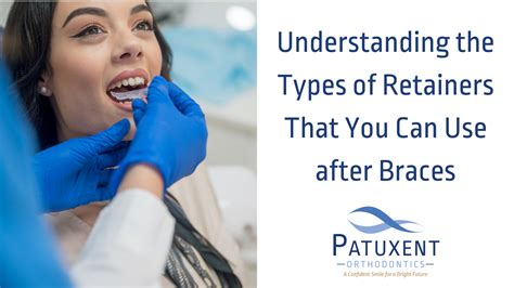 Types Of Retainers For Braces At Giuseppe Siegel Blog
