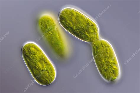 Cylindrocystis Sp Algae Light Micrograph Stock Image C057 4907