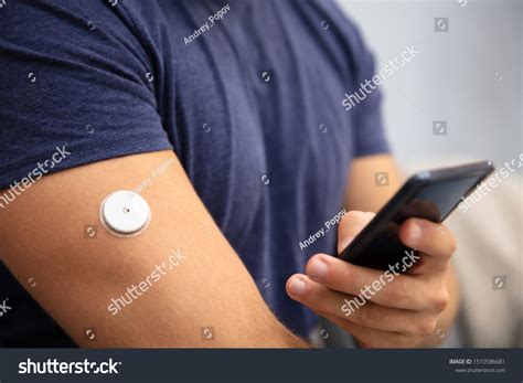 Diabetes Arm 4 399 Images Photos Et Images Vectorielles De Stock