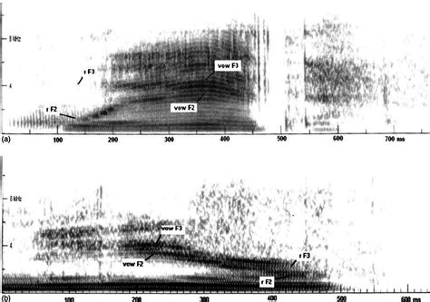 ͑ A ͒ A Spectrogram Of A Subjects Production Of The Word ‘‘red The