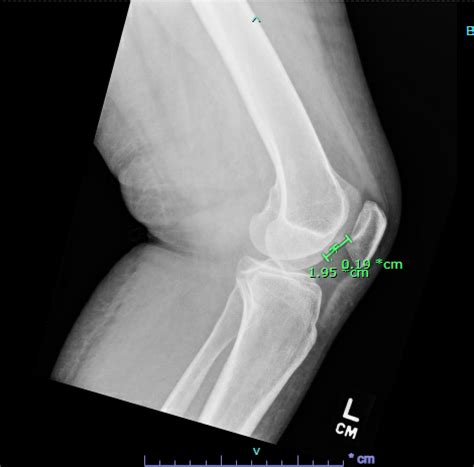 Notch Your Average Sign