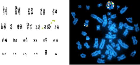 Figure 1 From Homogeneously Staining Region Hsr On Chromosome 11 Is