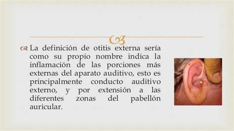 1 6 1 Otitis Externa Media E Interna