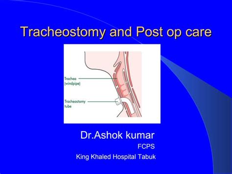 Tracheostomy And Post Op Care Ppt