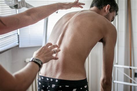 Scoliosis Most Often Develops During Growth Spurt Just Before Puberty