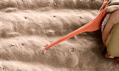 Bee Stinger Under Microscope