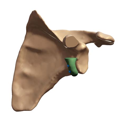 Latarjet Empower Your Surgery