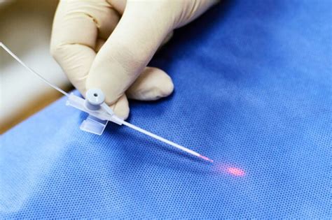 Varicose Vein Treatment In Melbourne The Vein Institute