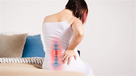 Understanding Sciatica Causes Symptoms And Solutions