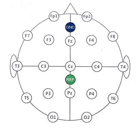 BCI For Stroke Rehabilitation Preprocessing And Deep Learning Poor Accuracy OpenBCI Forum
