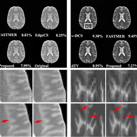Two Types Of Subsampling Patterns Left 1d Variable Density Random