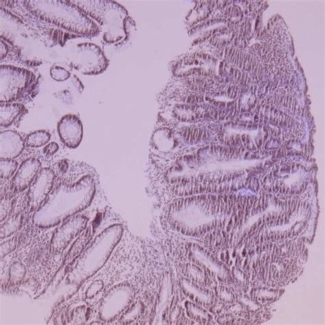 Results Of The Stain Normalization Techniques On A Sample Image From