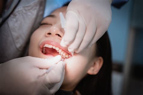 Extracting Wisdom A Comprehensive Guide To Wisdom Teeth Removal