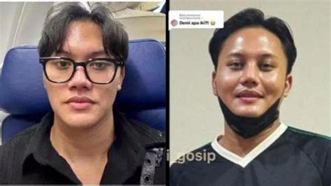Berita Alasan Rizky Febian Operasi Hidung Di Korea Terbaru Hari Ini Tribun Medan