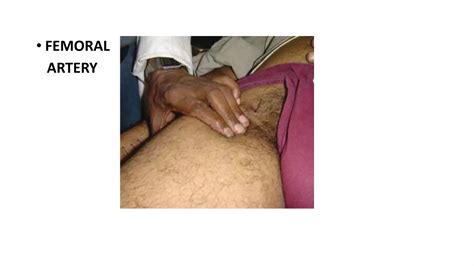 Pulse Arterial Pulse Types Pptx