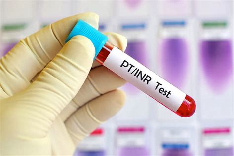 Inr Testing Machines How To Use Them At Home