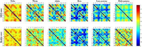 Figure 3 From A Novel Complex Network Based Graph Convolutional Network In Major Depressive