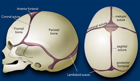 Cranial Sutures Figure 2 From Computerized Tomography Of Cranial