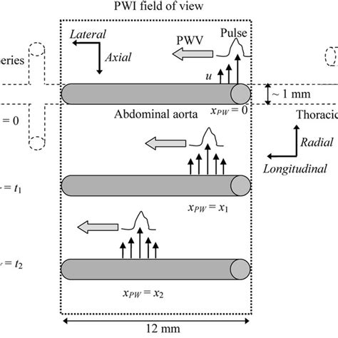 Illustration Of The Pulse Wave Propagation Along The Abdominal Aorta Download Scientific