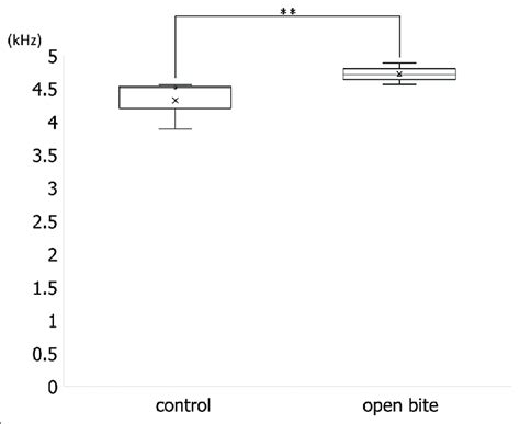Average Phonetic Analysis Of The Transition Part From A To S On F4