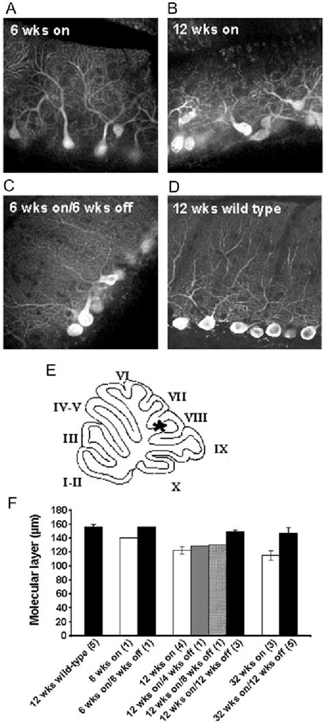 Figure 3 From Recovery From Polyglutamine Induced Neurodegeneration In Conditional Sca1