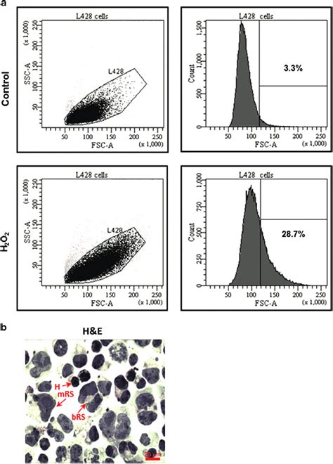 The Number Of Large Rs Cells Is Increased By Oxidative Stress Cells