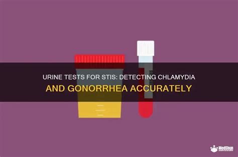 Urine Tests For Stis Detecting Chlamydia And Gonorrhea Accurately