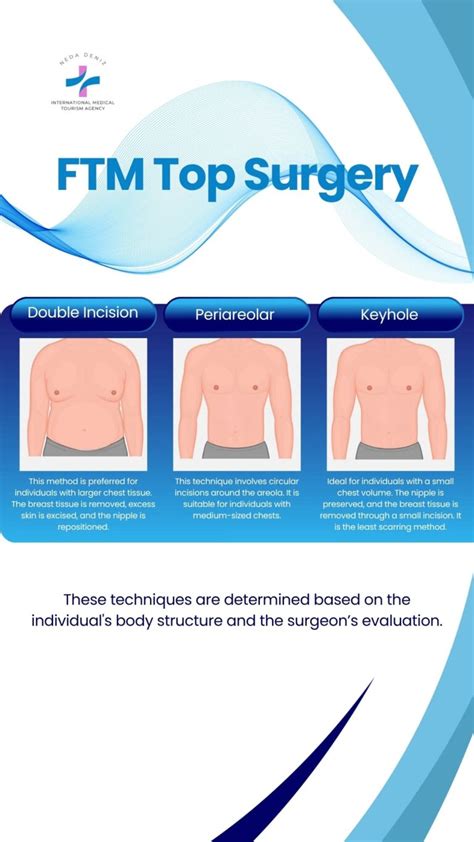 What Is Top Surgery Types Results And Recovery