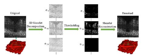 Figure 2 From Universal Digital Filtering For Denoising Volumetric Retinal Oct And Oct
