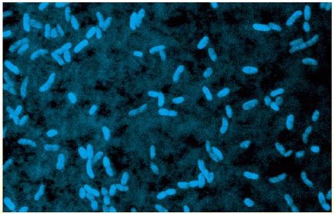 原核生物基因调控——1 原核生物基因表达的元素 知乎